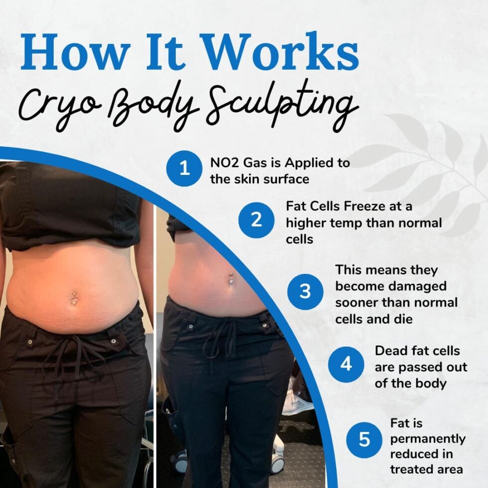 Cryo Body Sculpting | Platinum Cryo